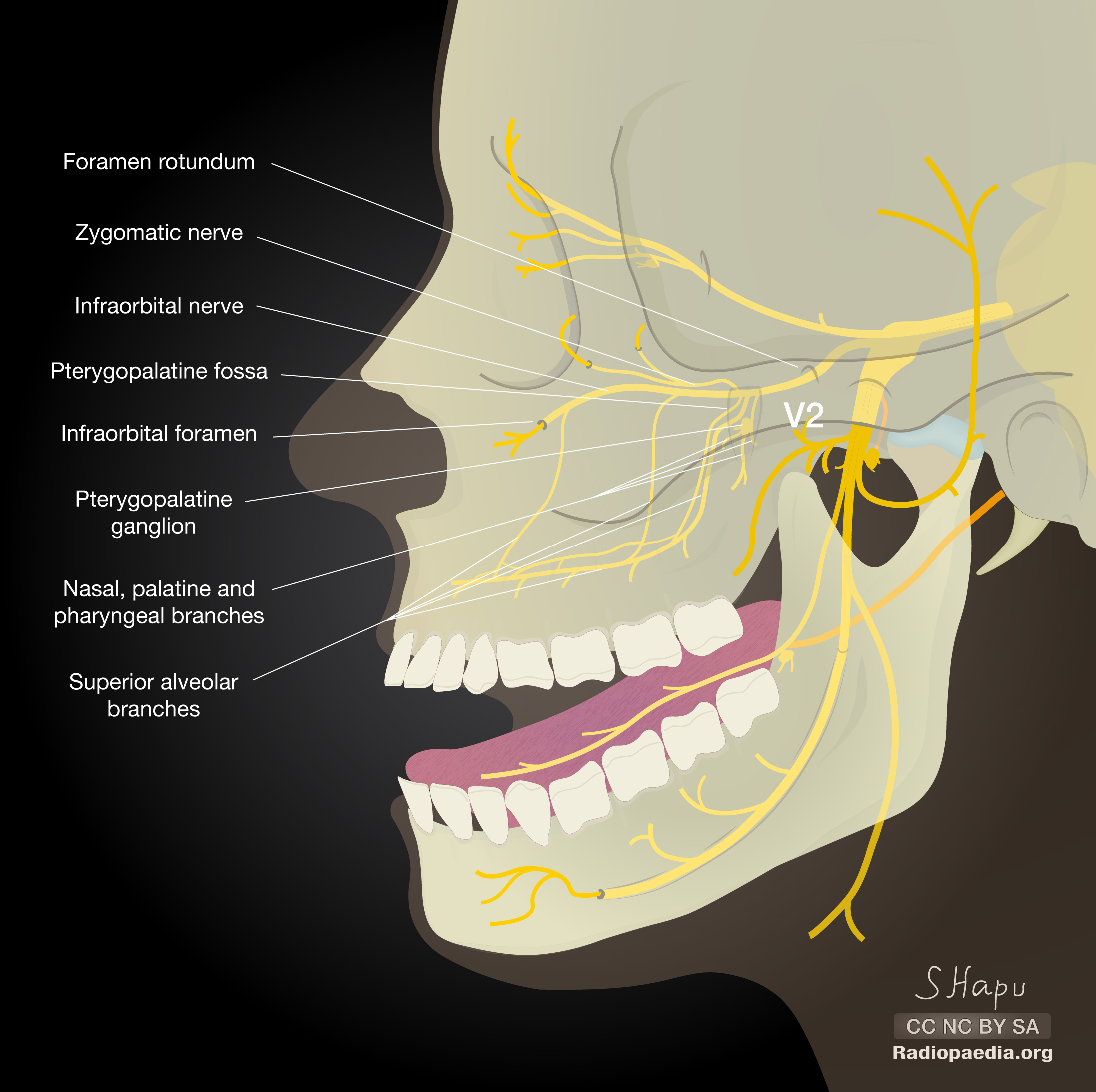 Radiopaedia - Drawing Main branches of the maxillary nerve - English labels | AnatomyTOOL